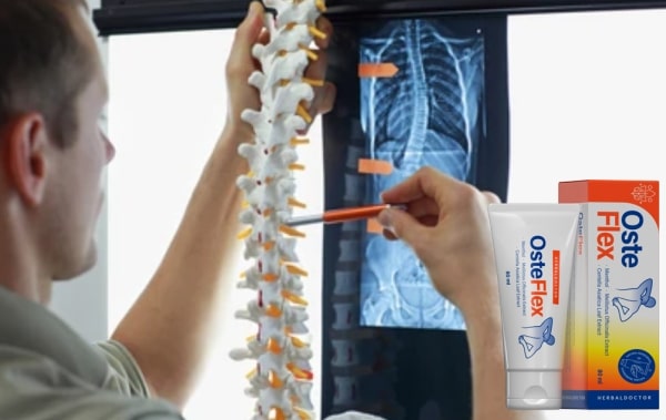 OsteFlex Мнения - крем за болки и артритни спазми