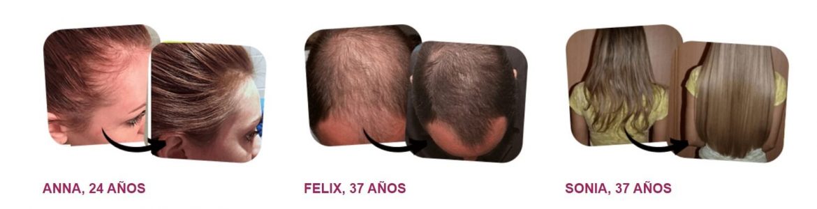 Hair Perfecta - ¿Spray para un cabello más grueso y saludable?