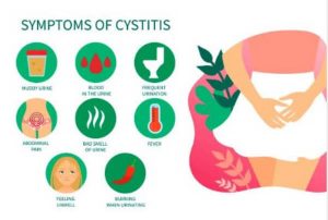 Cistat Review | Capsules for Healthy Urinary Tract | Price and Order?