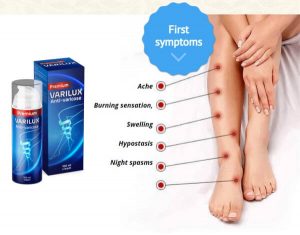 Varilux Premium Cream: fight the varicose veins naturally! | Price?