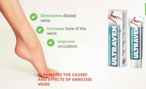 UltraVen Reviews | Gel to Eliminate Varicose Veins | Price
