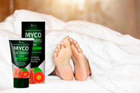 Myco Dermin Review | Anti-Fungal Cream For Foot Fungus | Price