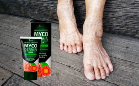 Myco Dermin Review | Anti-Fungal Cream For Foot Fungus | Price