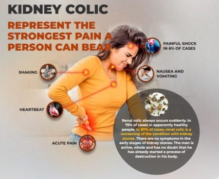 StoneOut Forte Review | For the Removal of Kidney Stones?