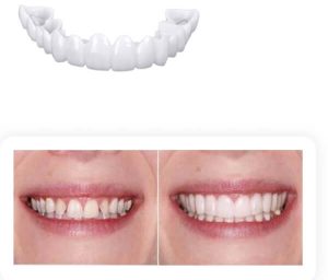 Snap-On Smile | Is It Effective? Reviews of Clients, Price?